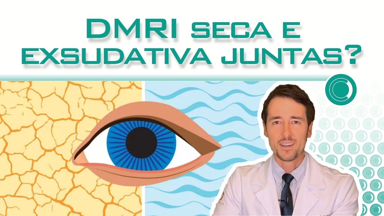 DMRI seca e exsudativa juntas ? - YouTube