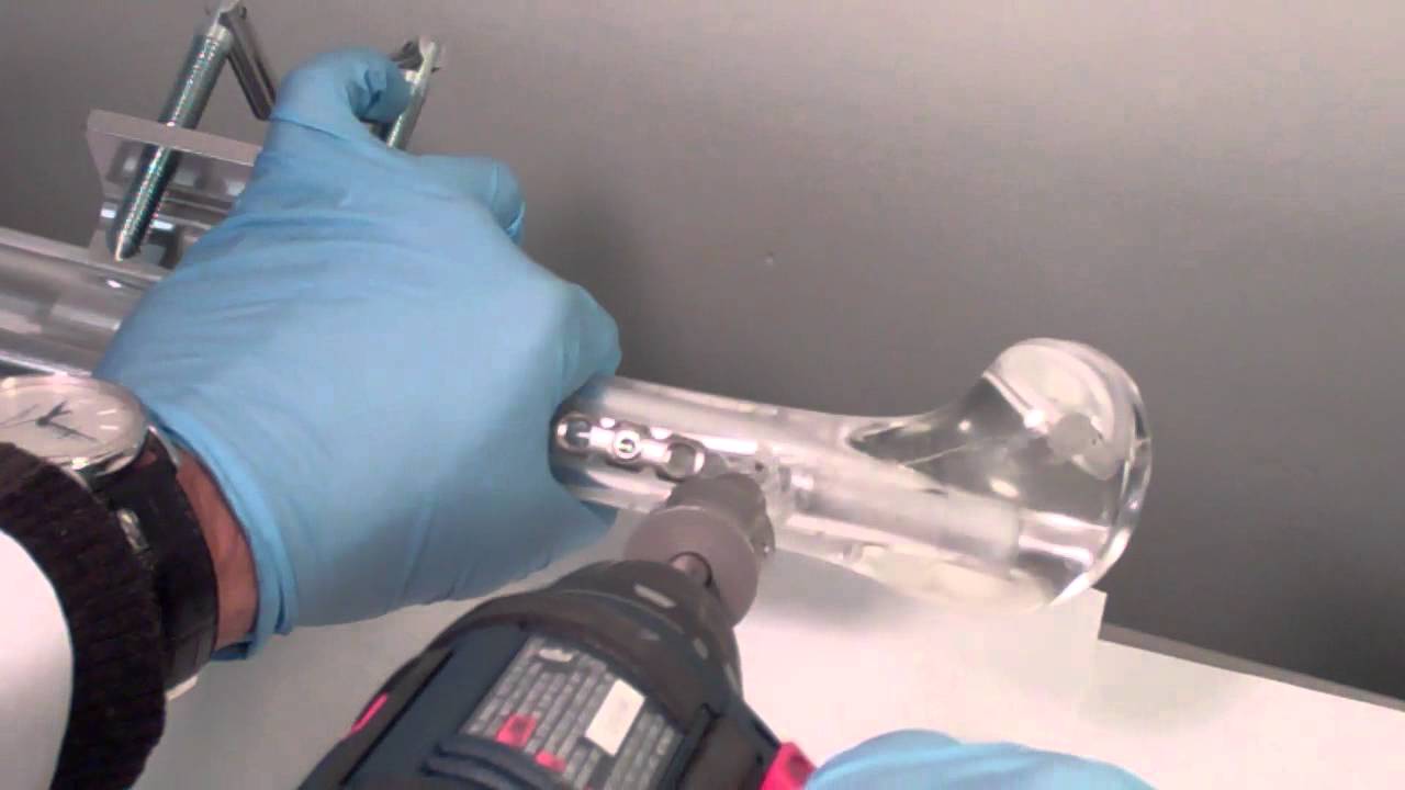 Shukla Medical Broken Screw Demo Video.MP4 - YouTube