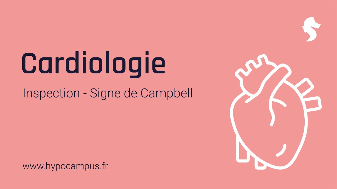 Signe de Campbell - Inspection de Cardiologie - YouTube