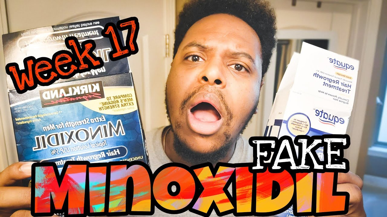 FAKE Minoxidil Week 17 by Loc'd In With Trey - YouTube