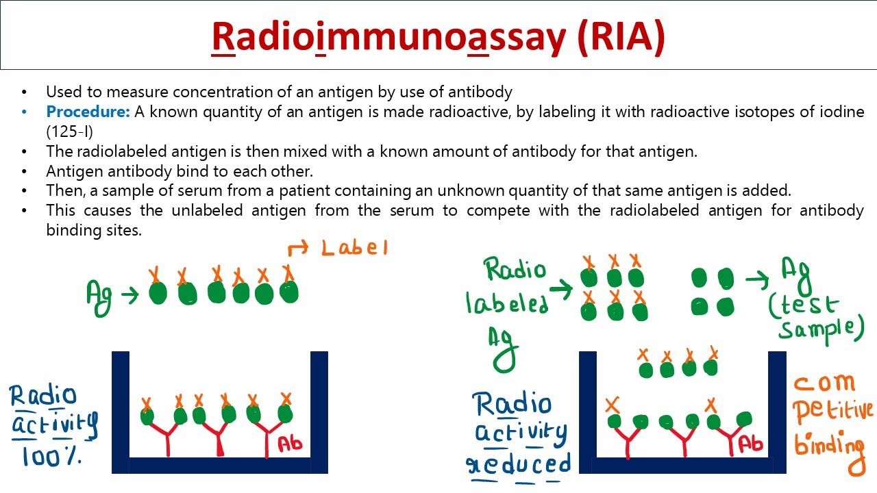 Radioimmunoassay | RIA - YouTube