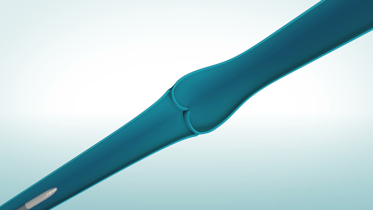 LeMaitre Valvulotome - Self-Sizing Design - YouTube