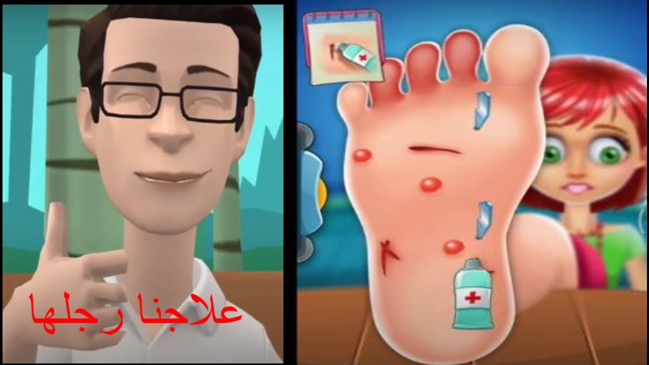 يلا نعالج اقدام الاطفال foot doctor - YouTube