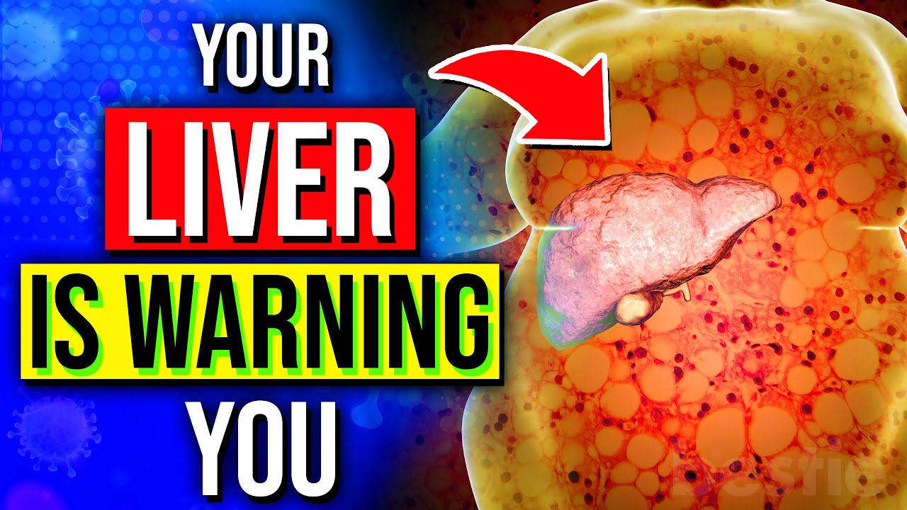 14 Unhealthy Signs Your Liver Is Warning You About - YouTube