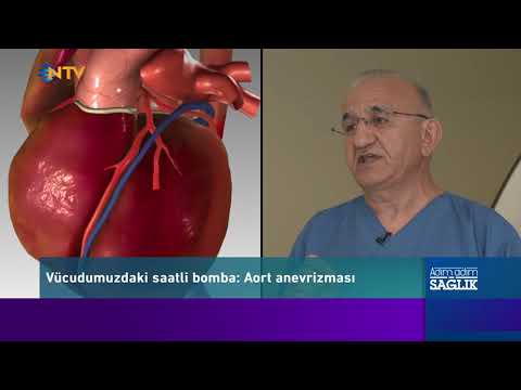Vücudumuzdaki Saatli Bomba: Aort Anevrizması