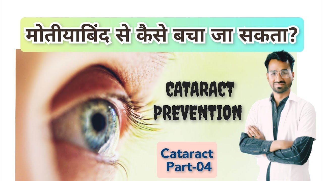 CATARACT PART- 4 | Prevention of Cataract | SAFED MOTIYA BIND| - YouTube