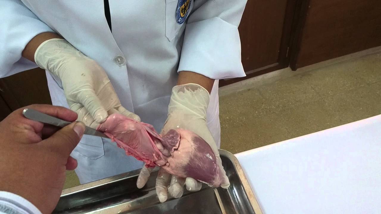 Explicación de pericardio por estudiante de Enfermería. - YouTube