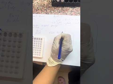 2-Merkaptoetanol-Rivanol Brucella tanısı(akut-Kronik)