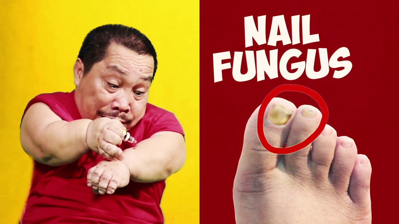 L043P102918F DAGUL 4mL 15s - YouTube