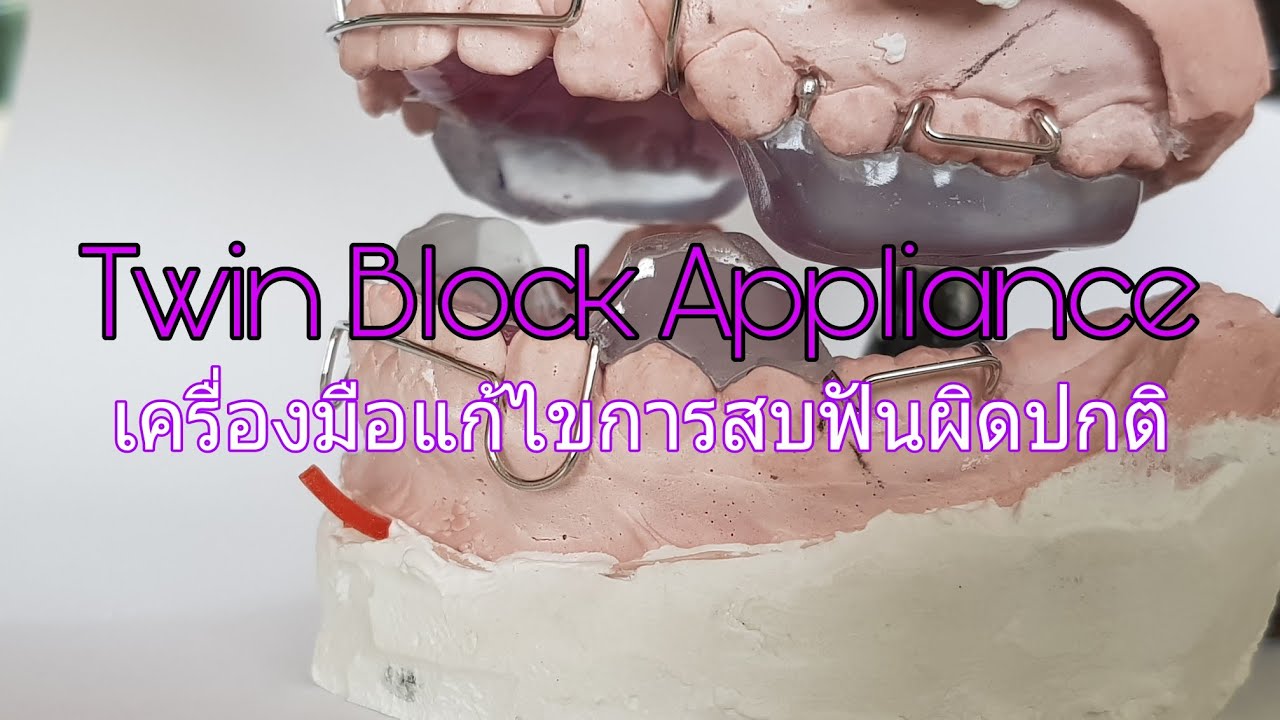Twin Block Appliance Youtube | Twin Block Appliance: A Comprehensive ...