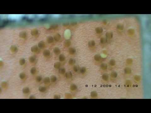 06 Discus Egg Turn Dark 36 hours by 2discus - YouTube