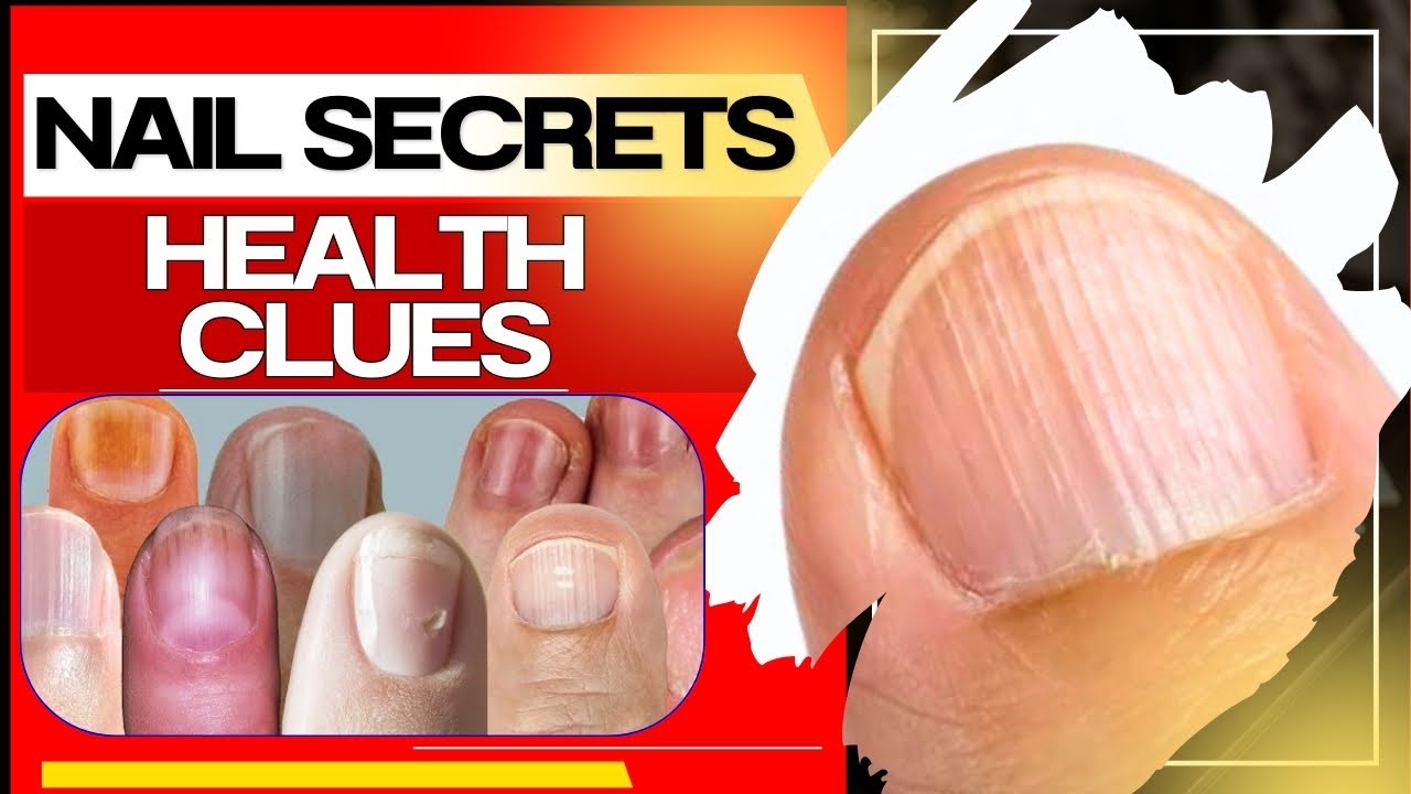 5 Things Your Nails Can Tell You About Your Health - YouTube
