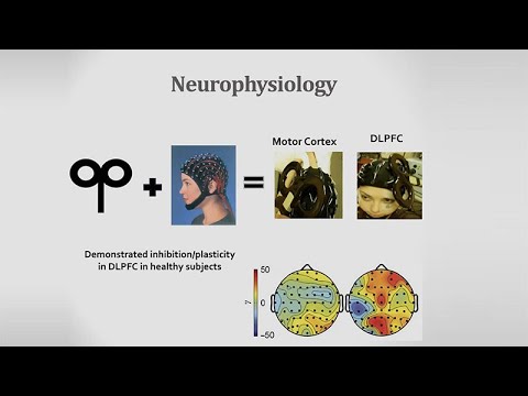 Magnetic Seizure Therapy for Treatment Resistant Depression with Jeff ...