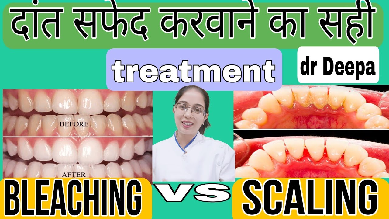 Difference between scaling and bleaching||स्केलिंग और ब्लीचिंग में क्या ...