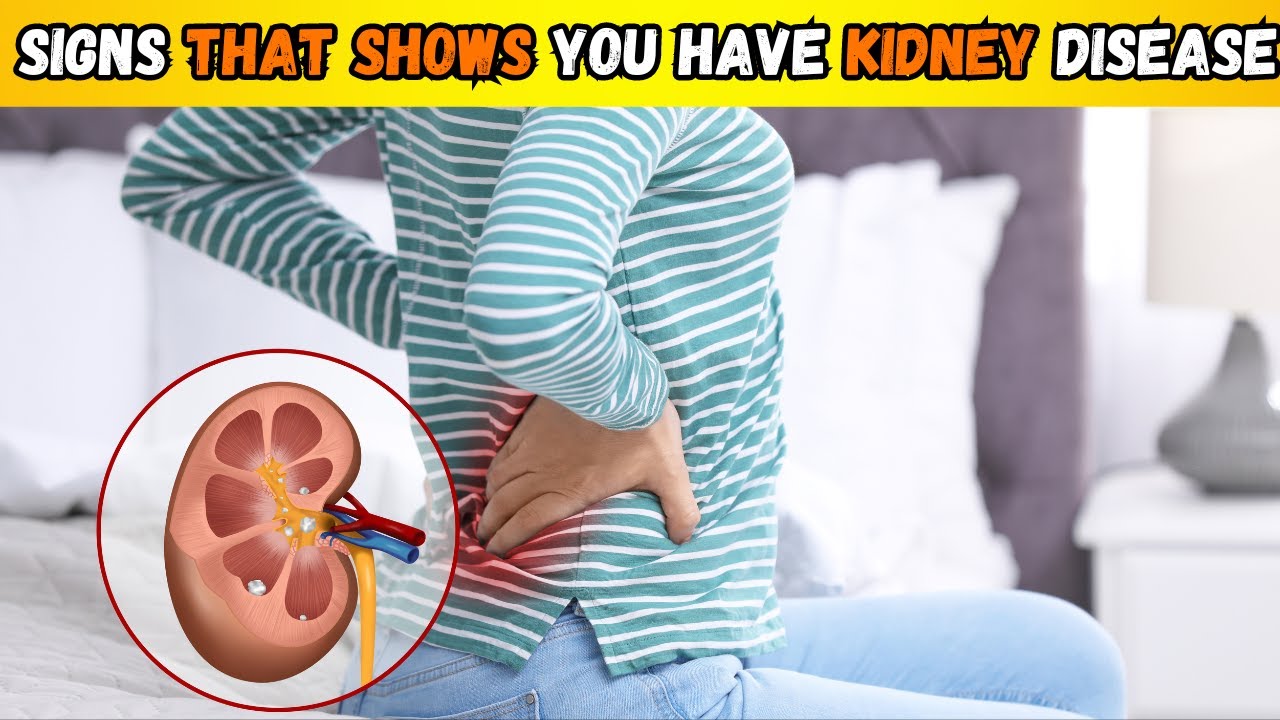 SIGNS THAT SHOWS YOU HAVE KIDNEY DISEASE - YouTube