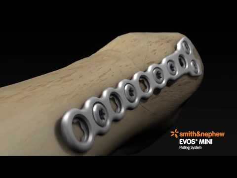 EVOS MINI Plating System - YouTube