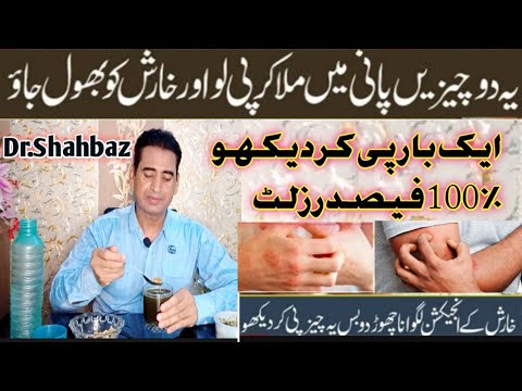 Kharish Khatam Karne Ka Tarika | Kharish Ka Ilaj In Urdu | Itching ...