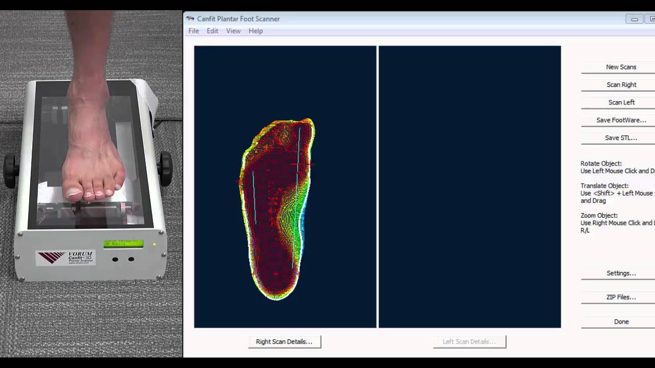 Vorum Products: 3D Plantar Scanner - YouTube