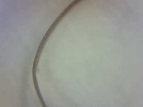 Morgellons Nano-Wire Antenna - YouTube