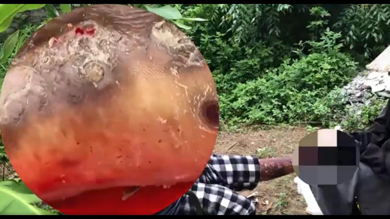😱 Extreme Jigger Infestation – Flesh Falling Apart! #UZ2652 - YouTube