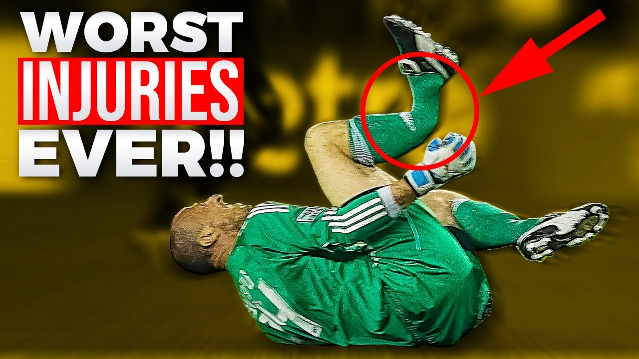 Footballs Most SHOCKING Injuries Ever - YouTube