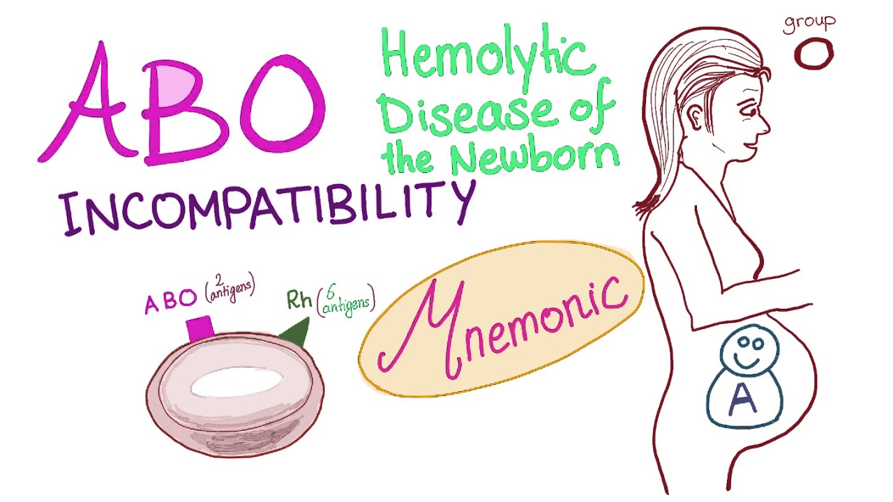ABO incompatibility mnemonic - Hemolytic Anemia - Normocytic Anemia ...