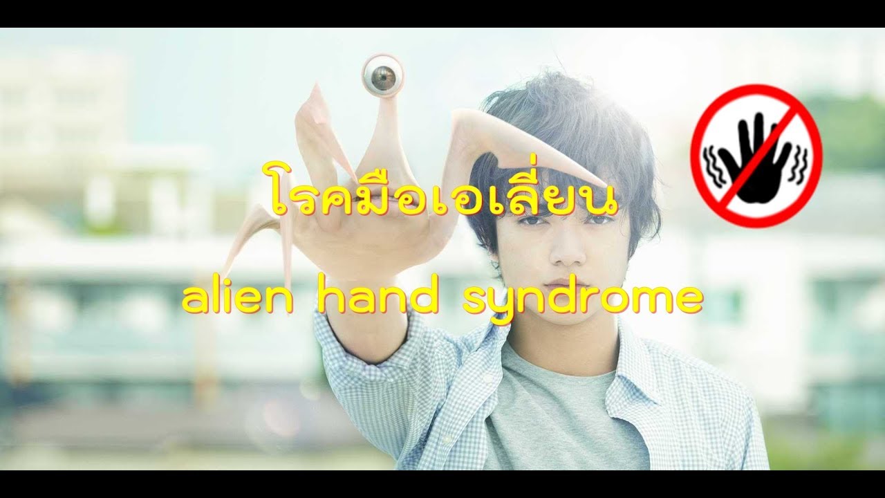 โรคมือเอเลี่ยน หรือ alien hand syndrome - YouTube