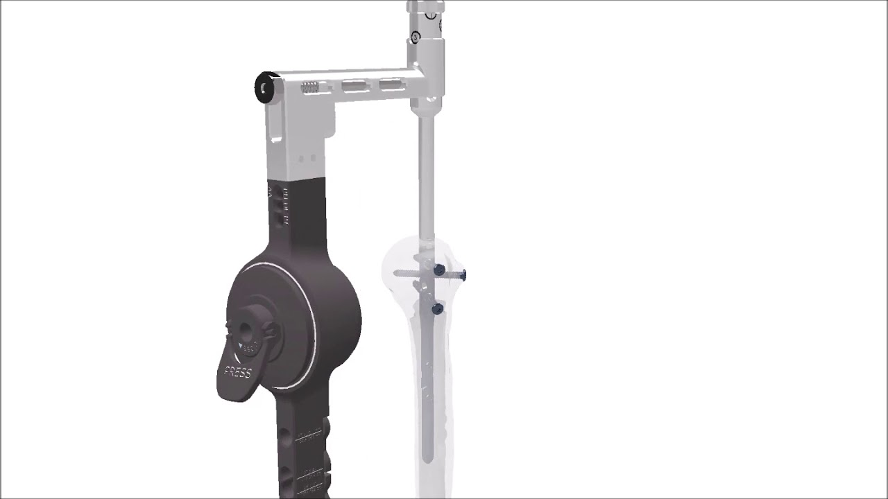 PAN PH Surgical Technique - YouTube
