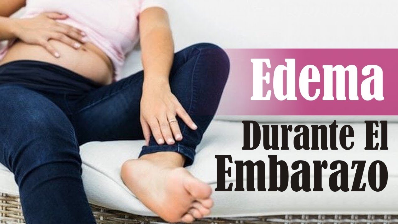 Remedios caseros para los EDEMAS durante el embarazo - YouTube