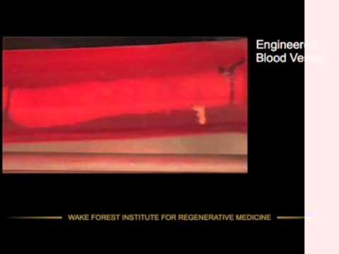 Tissue Engineering: Bioreactors 2 - blood vessels - YouTube