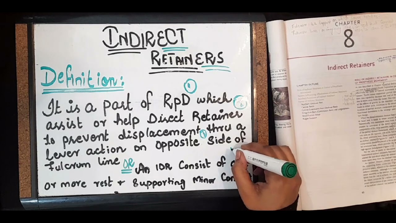 Introduction + Definition of Indirect retainer (part 1) - YouTube