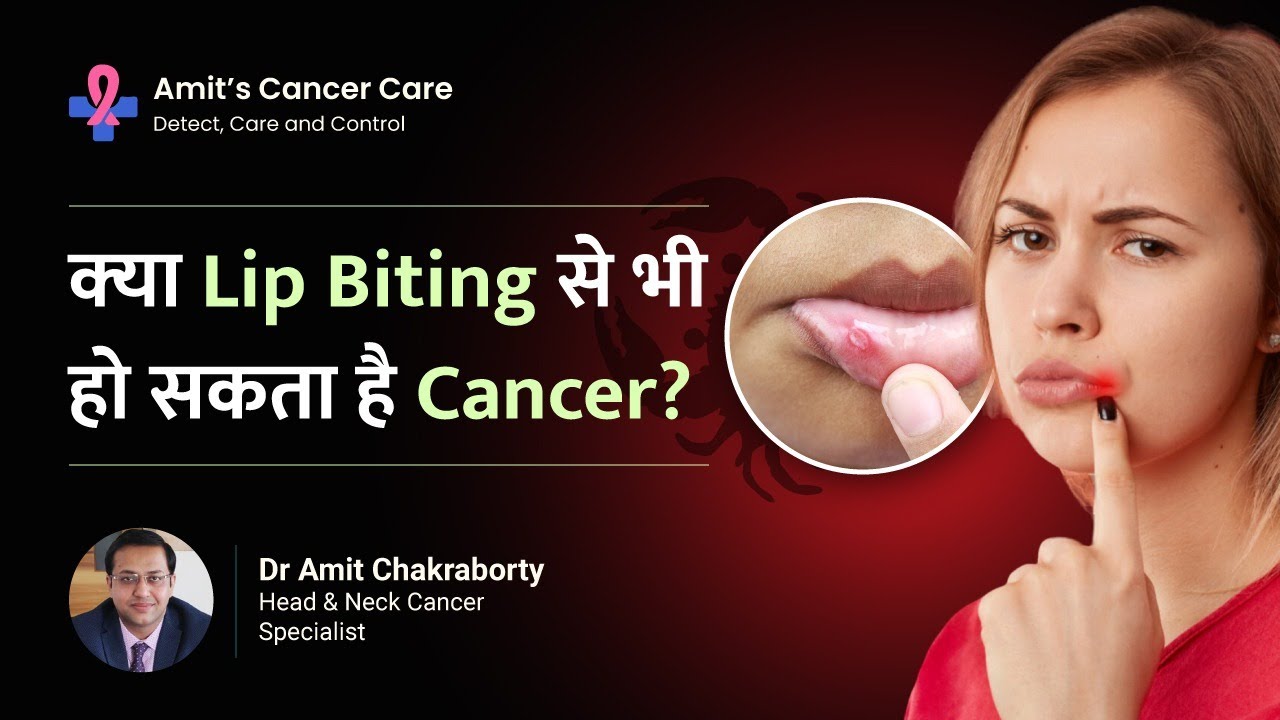 क्या Lip Biting से भी हो सकता है Cancer? | Signs & Symptoms of Lip ...