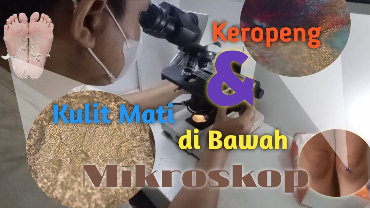 Keropeng dan Kulit Mati di Bawah Mikroskop - YouTube
