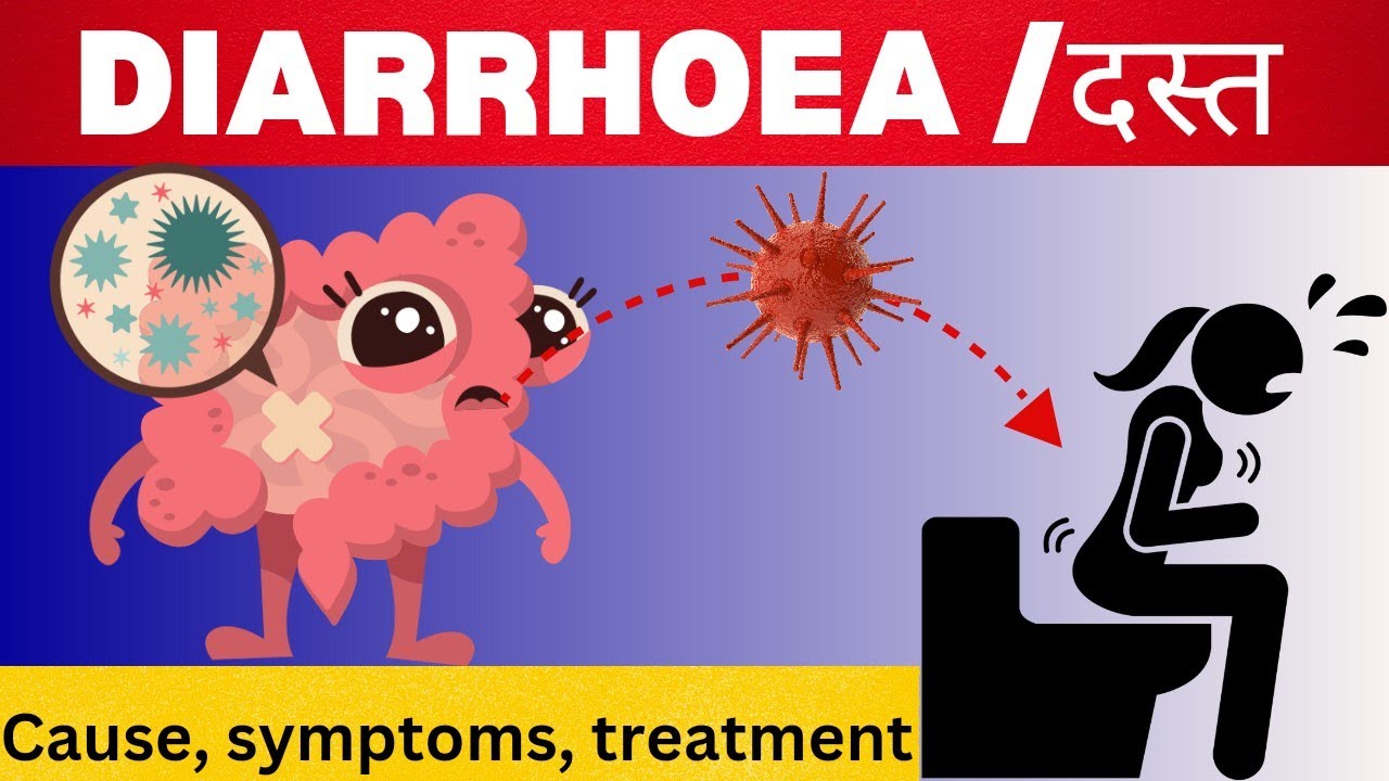 Diarrhoea - causes symptoms treatment (डायरिया ) - YouTube