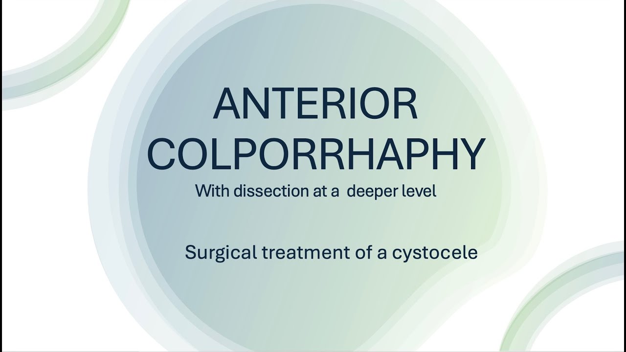 Anterior colporrhaphy with deep dissection technique - YouTube