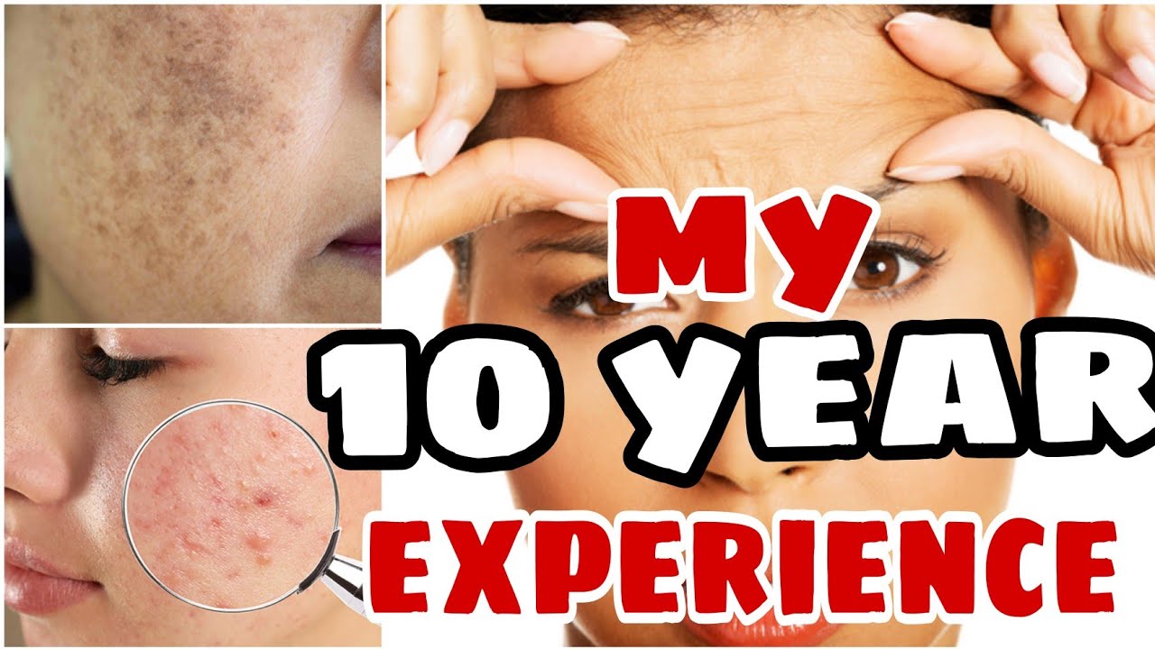 How I RECOVERED from my 10 year long pimple problem/MEDICAL PROOF/My ...
