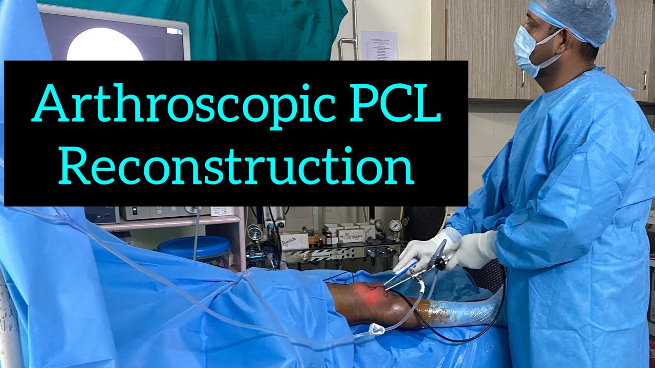 Arthroscopic PCL Reconstruction a detailed surgical video. - YouTube
