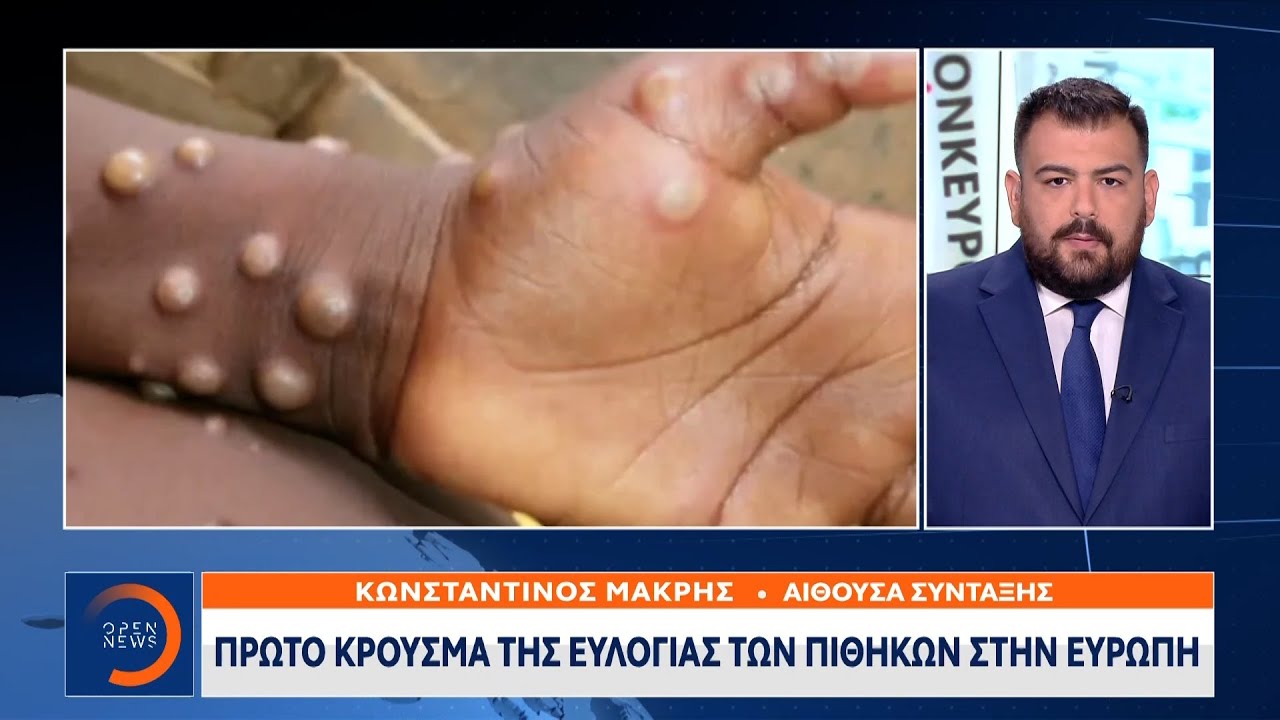 Πρώτο κρούσμα της ευλογιάς των πιθήκων στην Ευρώπη | OPEN TV - YouTube