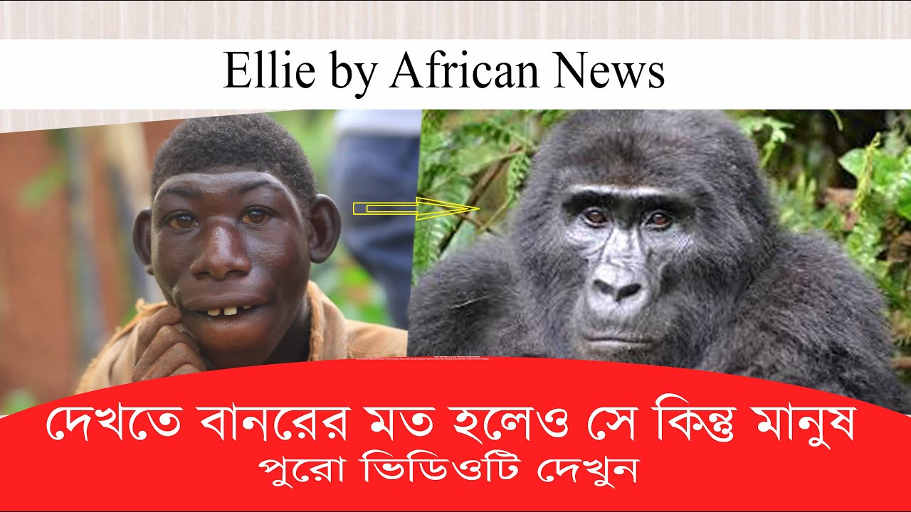Ellie looks like monkey and People call him monkey boy || Sakunews360 ...