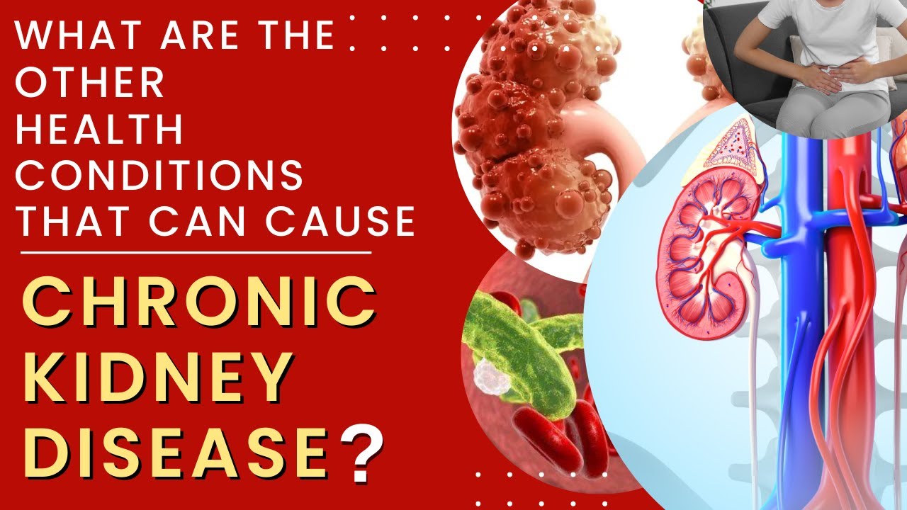 What Are The Other Health Conditions That Can Cause CKD ? - YouTube