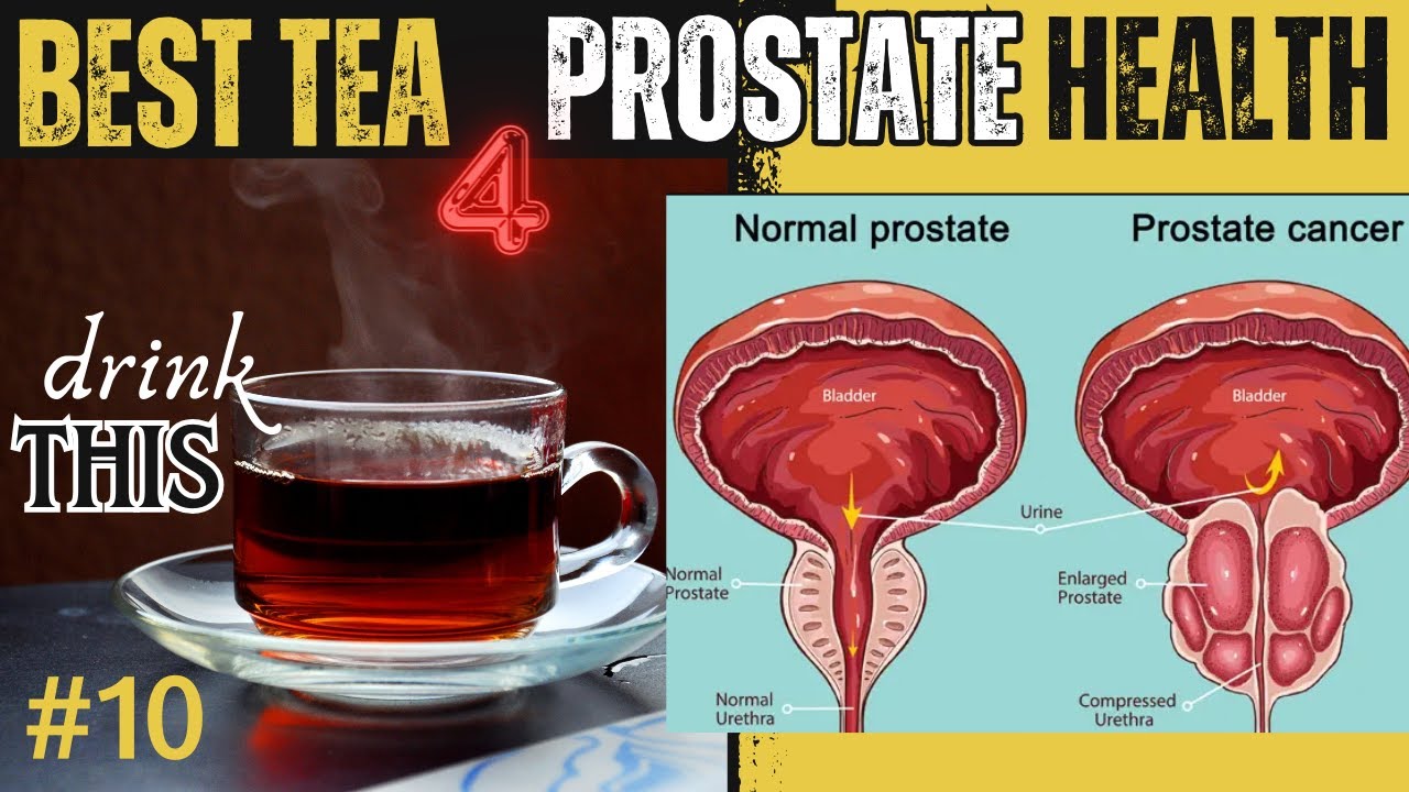 Top 10 Healthiest Tea for Your Prostate Health Benefits - YouTube