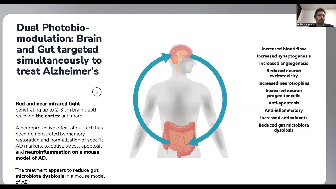 Brain-Gut Photobiomodulation: Preclinical and Clinical Studies for ...