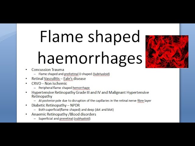 Retinal Hemorrhage Hypertension