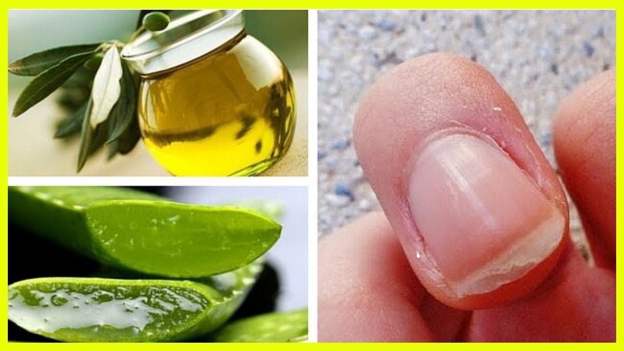 ¿Por qué se descaman las uñas? Causas, tratamientos y soluciones - YouTube