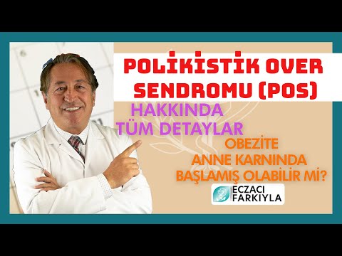 Polikistik Over Sendromu (POS) Hakkında Tüm Detaylar