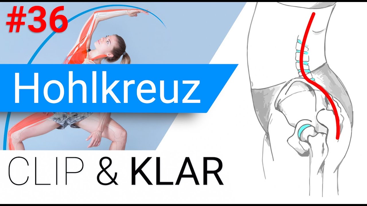 Hohlkreuz erklärt - Muss nicht sein! - YouTube