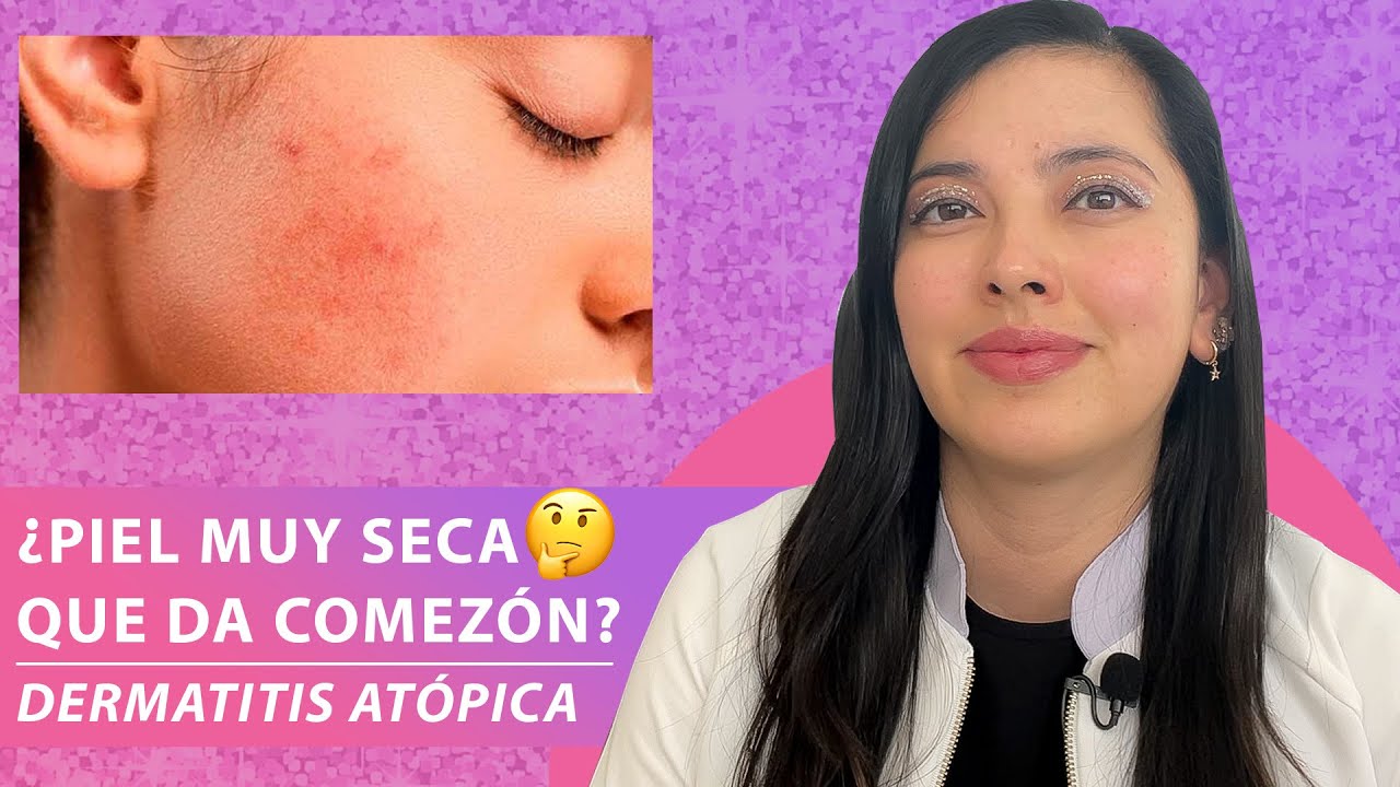 Piel muy seca que da comezón? Podría ser DERMATITIS ATÓPICA - YouTube