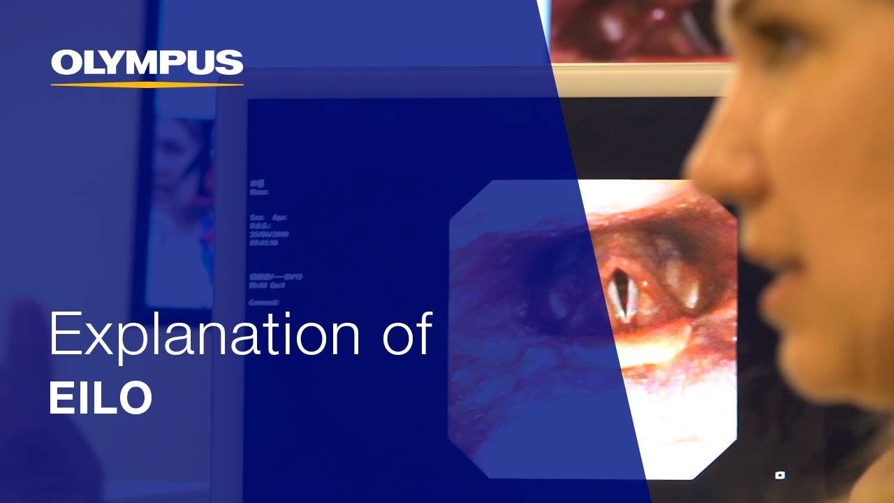 Explaining exercise induced laryngeal obstruction (EILO) - YouTube