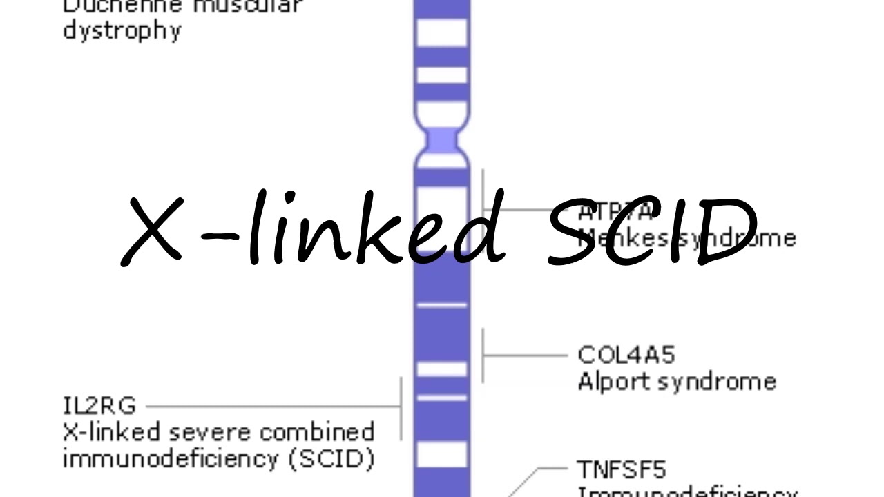 How to Pronounce X-linked SCID? - YouTube