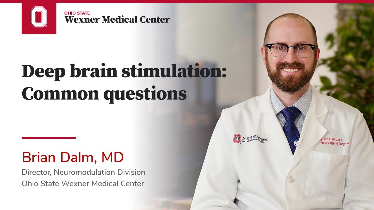 Deep brain stimulation: Common questions | Ohio State Medical Center ...